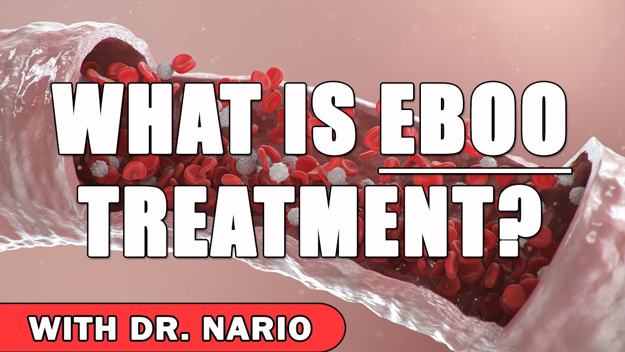 What Is EBOO Treatment? - With Dr. Nario - YouTube