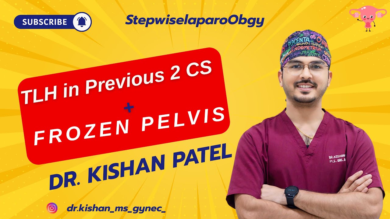 TLH | Frozen Pelvis with Multiple Omental Adhesions | Previous 2 CS ...