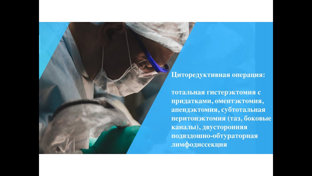 Ovarian cancer. Cytoreduction. - YouTube