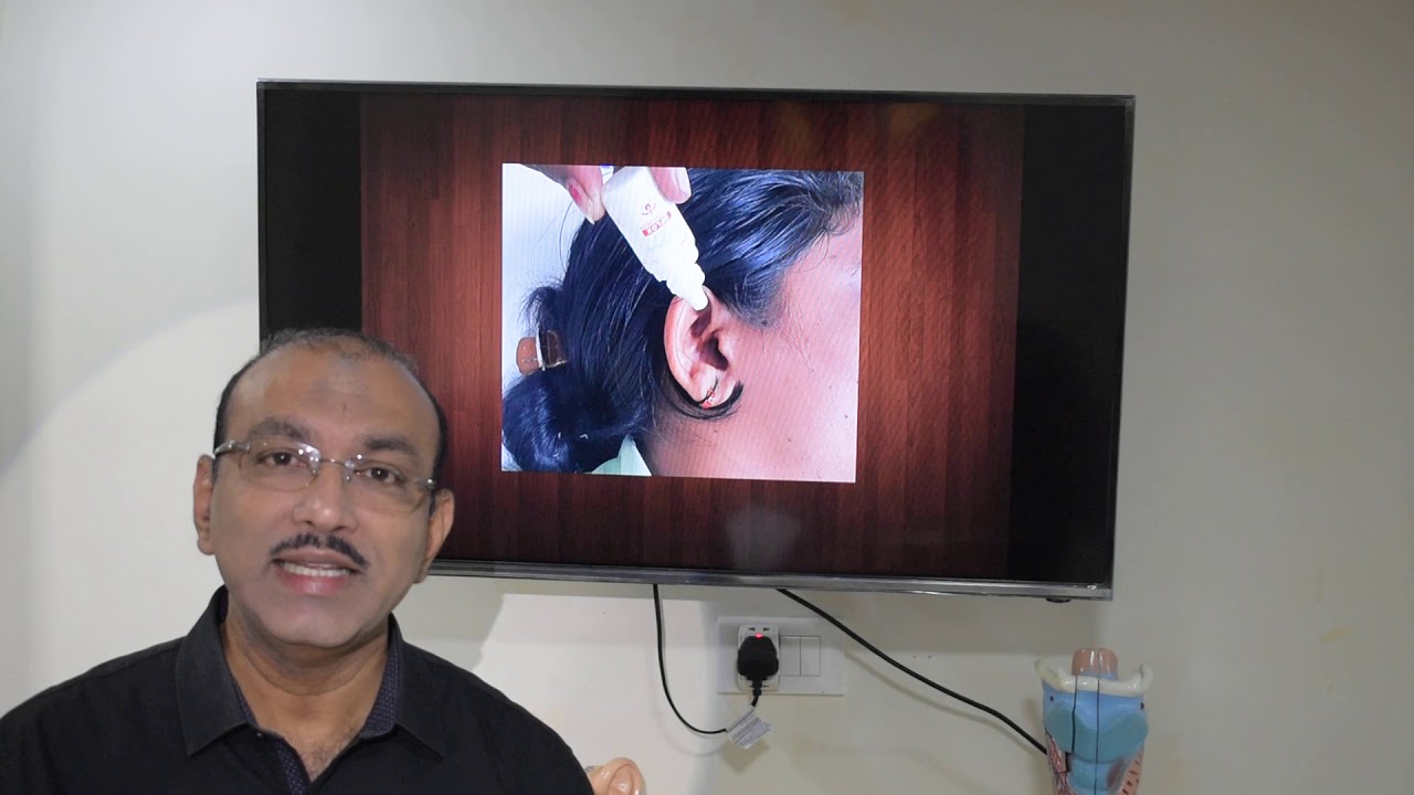Fungal infection of ear (Otomycosis) English. Patient teaching ...
