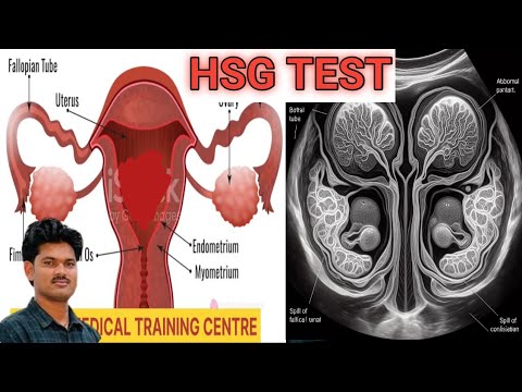 HSG TEST FULL PROCESS AND DETAILS, Fallopian tube recanalization # ...
