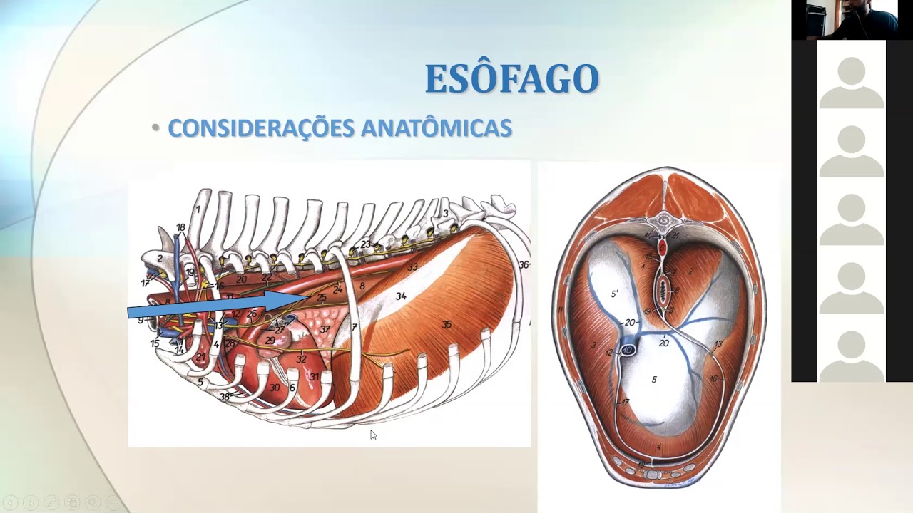 Cirurgia do esôfago turma Tarde - YouTube