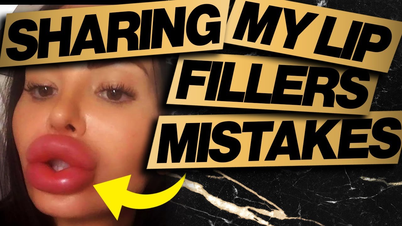 4 Tips From Botched Lip Filler Patients - YouTube