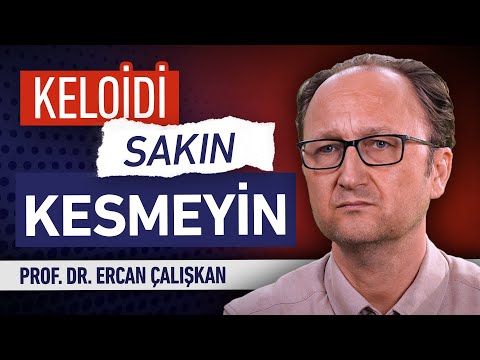 Keloid Tedavisi Nasıl Yapılır | Prof. Dr. Ercan Çalışkan