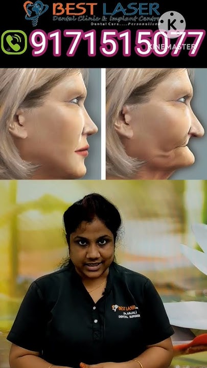 முழு கழட்டி மாட்டும் பல் செட் போட்டால் தாடை எலும்பு கறையுமாஇம்பிளான்ட் மூலம் தீர்வு Shorts