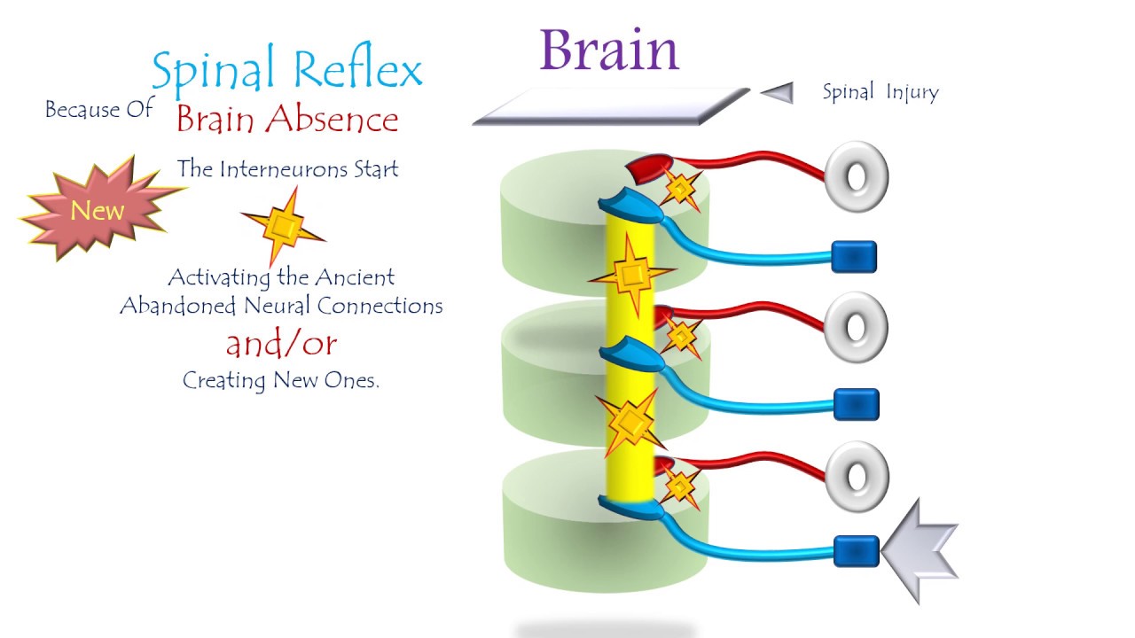 Hyperreflexia (3), Multi- Response Hyperreflex - YouTube