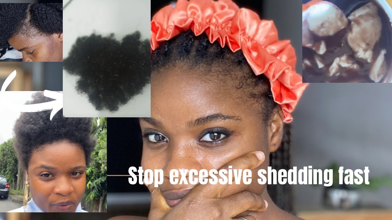 WANT TO STOP EXCESSIVE SHEDDING FAST!!! STOP HAIR LOSS! THINNING EDGES ...