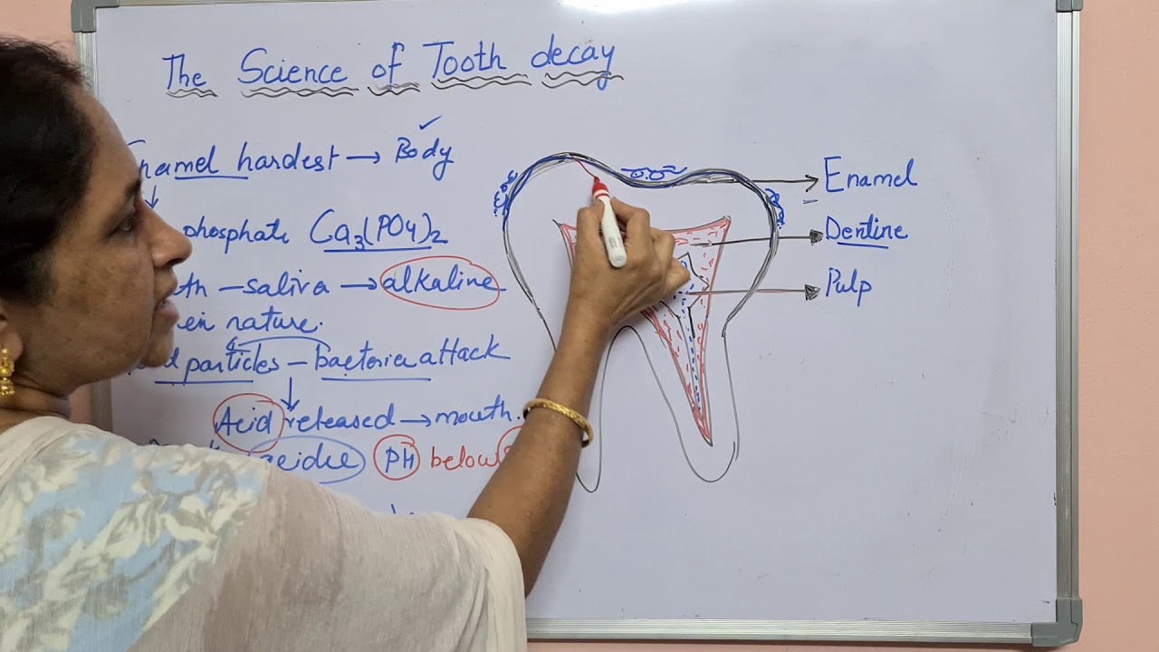 Tooth decay • Class X • Chemistry - YouTube