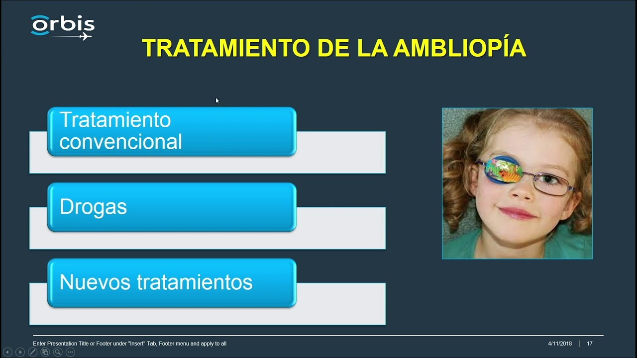 Conferencia: Ambliopia - YouTube