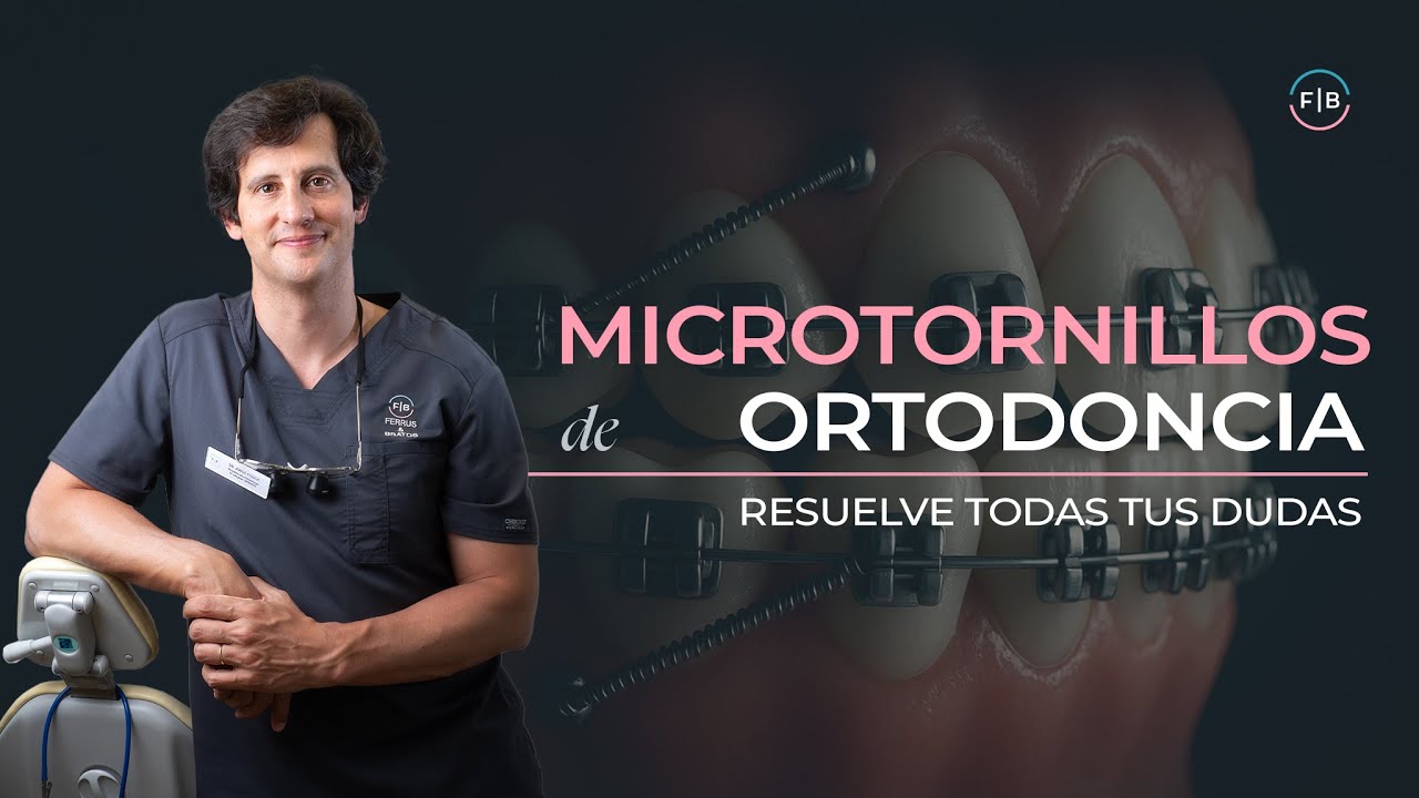 ¿Qué son los microtornillos de ortodoncia? Resolvemos todas tus dudas ...