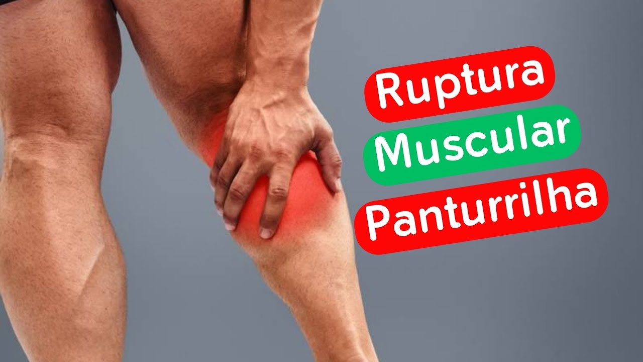 RUPTURA MUSCULAR PANTURRILHA - Dr. Prof. Nelson Marques - YouTube