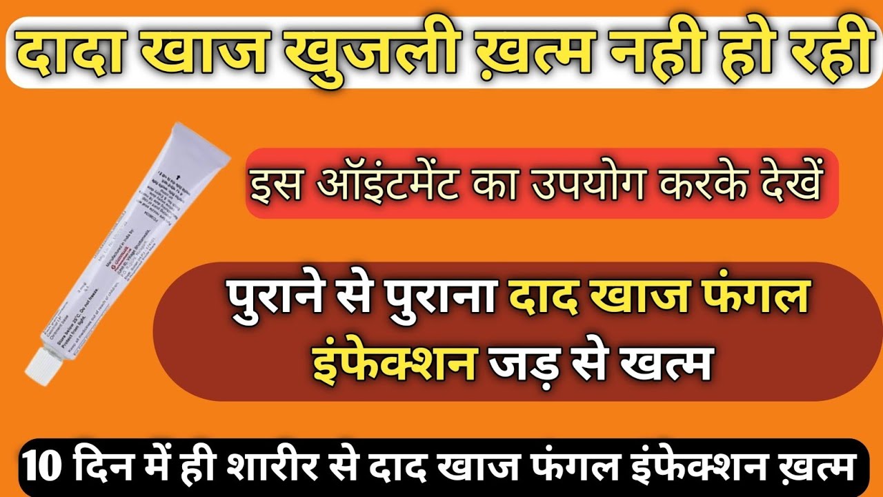 Dad khaj khujli ki Dva |Candipraz oc cream kis kaam Aati hai ...