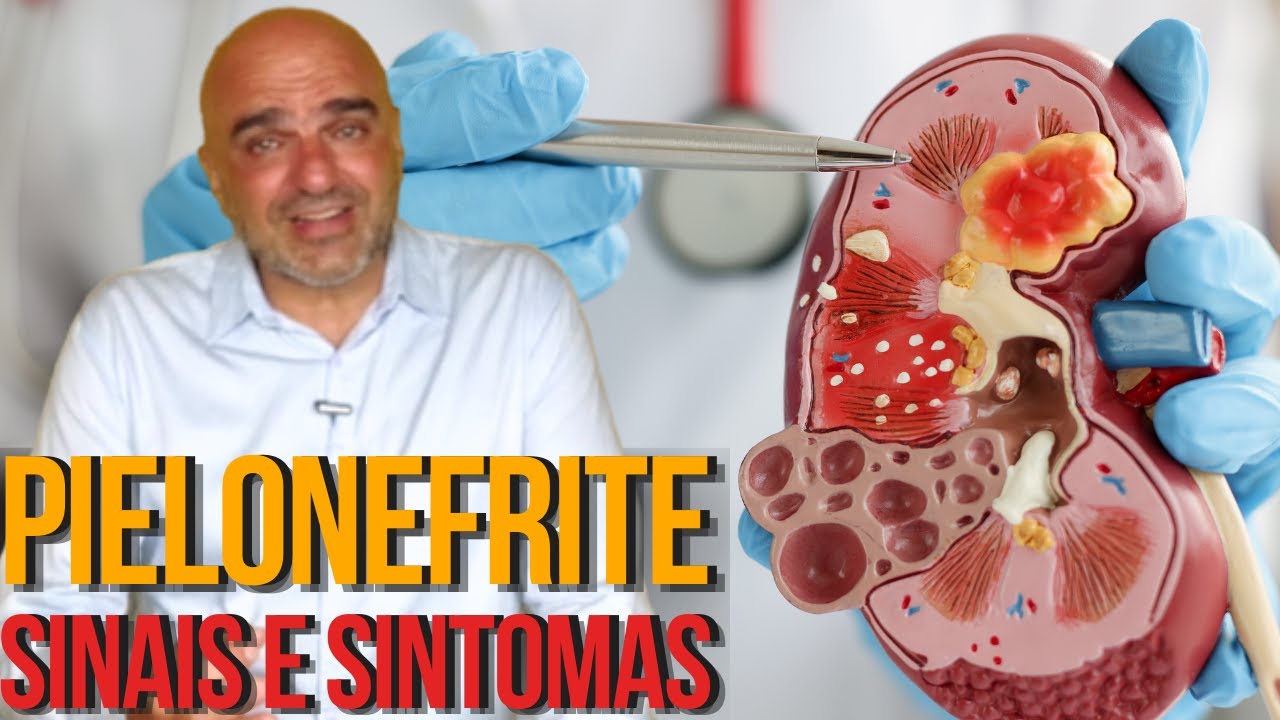 INFECÇÃO dos RINS: o que é pielonefrite? O que causa? Quais os sintomas ...