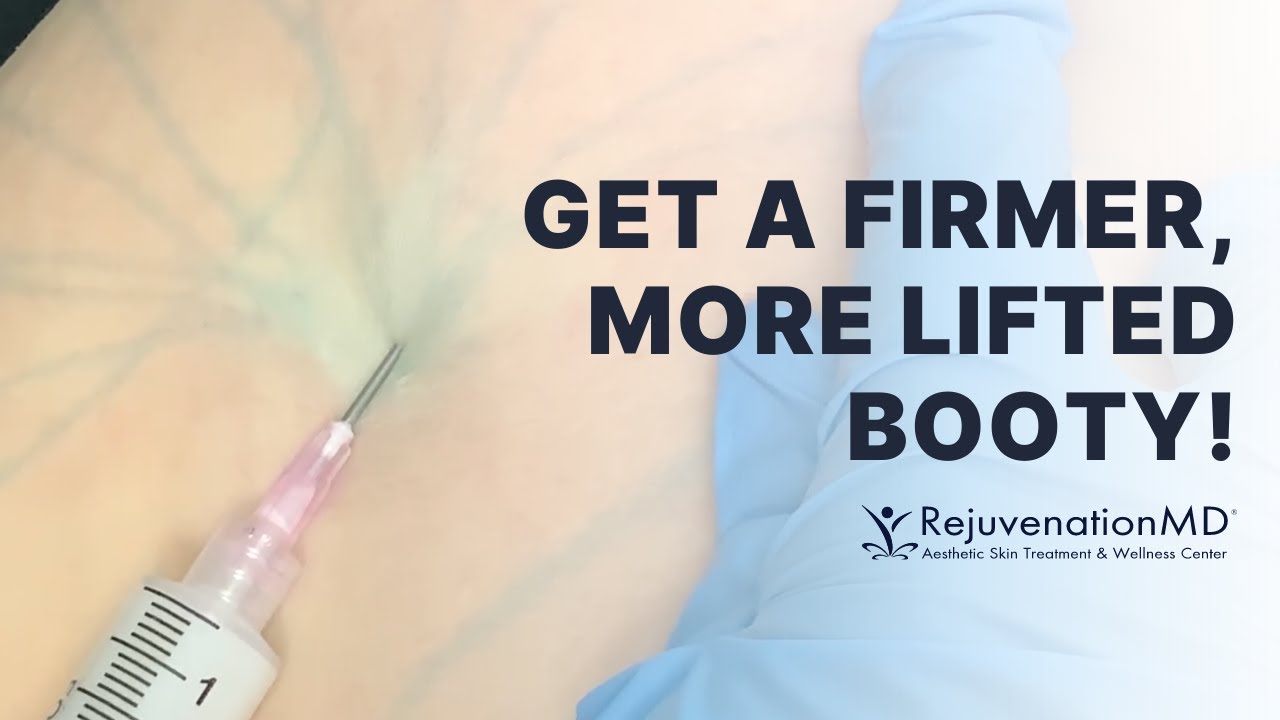 PRP, Radiesse, and Sculptra: 3 Top Non-Surgical Options for a Butt Lift ...