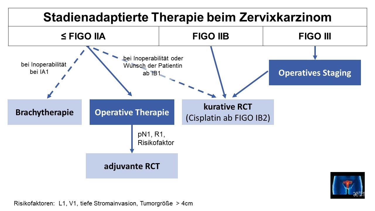 Stadienadaptierte Therapie beim Zervixkarzinom (bis FIGO III ...