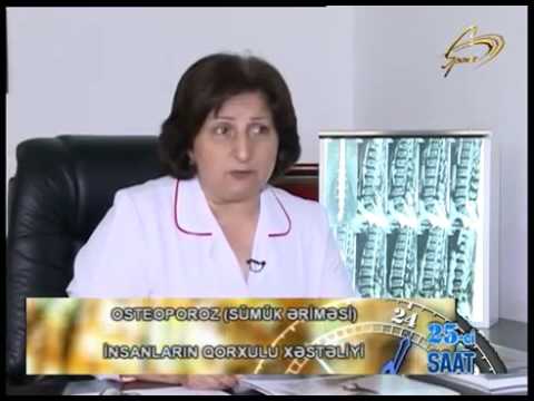 Dr.İradə Hacıyeva OSTEOPOROZ-sümük əriməsi haqqında məlumat verdi