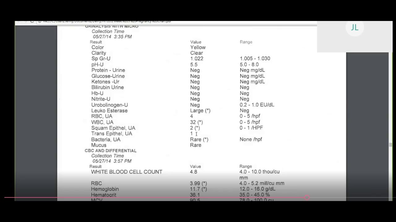 Coding a Complicated Obstetrical Inpatient Coding Case - YouTube