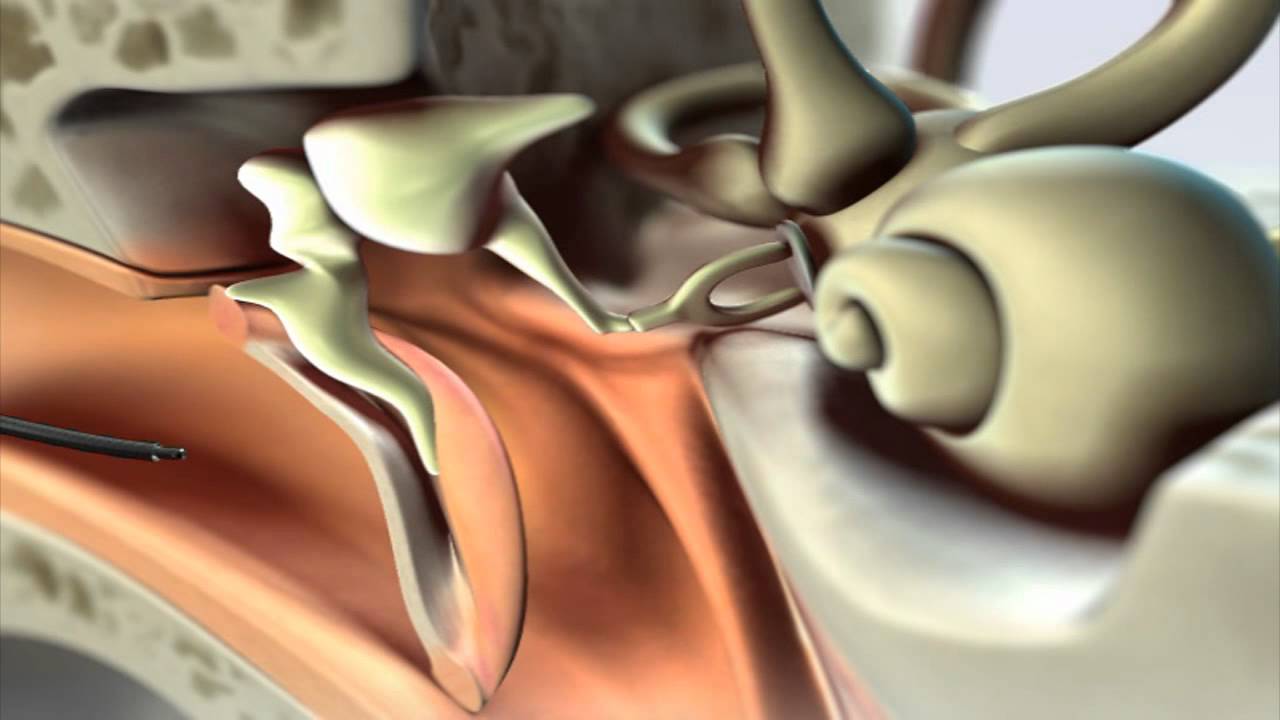 Stapes Animation Using CO2 Laser Fiber - YouTube