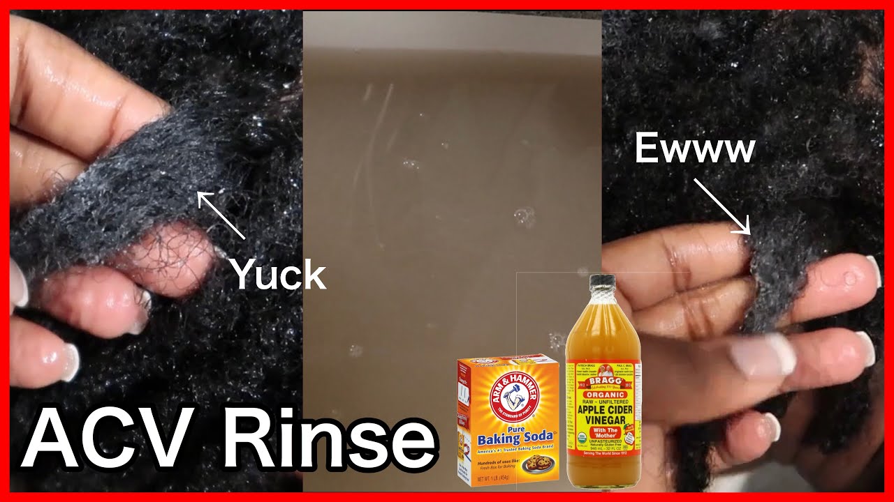 ACV Rinse on DIRTY 4 month starter Locs: Great Result | #KUWC - YouTube