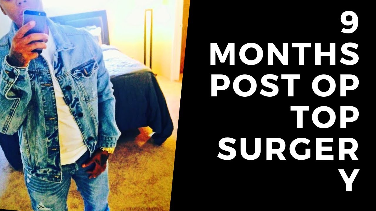 9 months Top Surgery Post Op | Dr Garramone | Top Surgery Scar Care ...