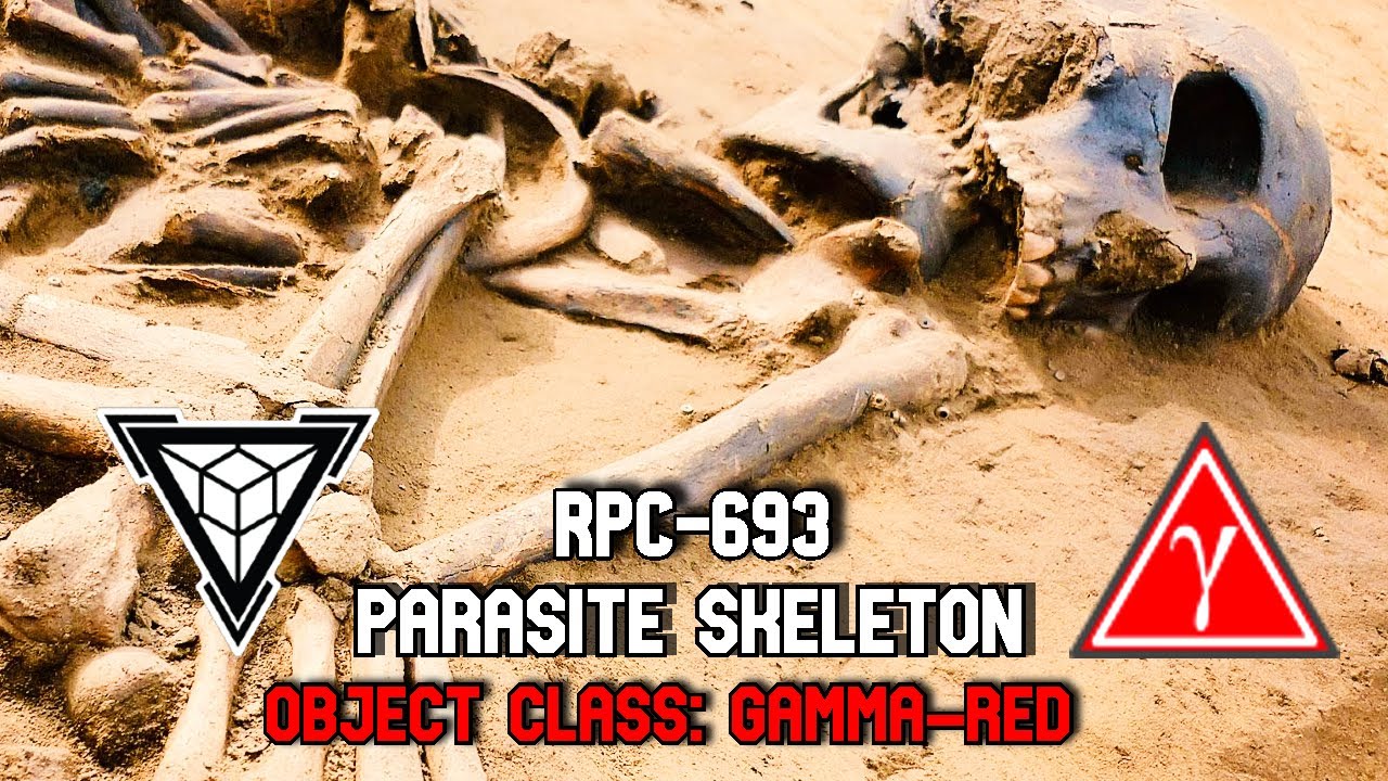 RPC-693 Parasite Skeleton - Cracks in the Skeleton: When Your Bones ...