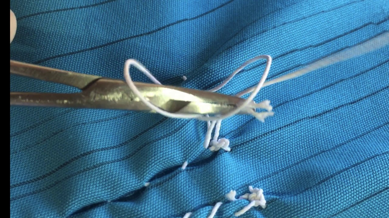 Punto sarnoff - YouTube