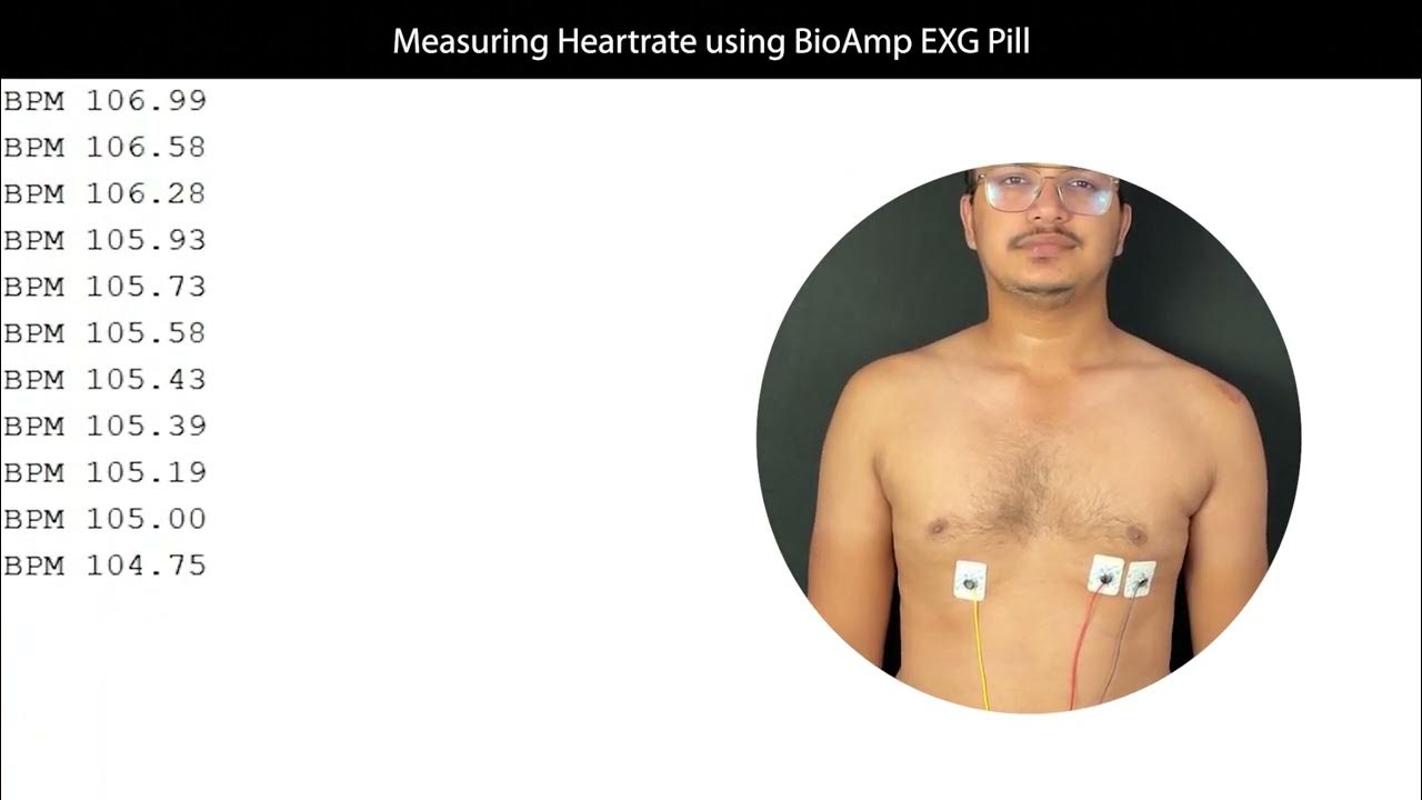 Measuring Heart Rate using BioAmp EXG Pill | ECG | DIY Neuroscience Kit ...