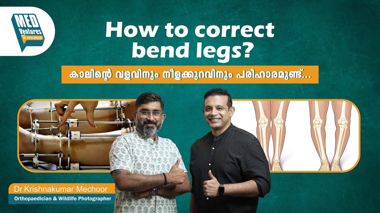 MedVentures|How to correct bend legs?|Dr.KrishnaKumar Mechoor|Dr.Vivek ...
