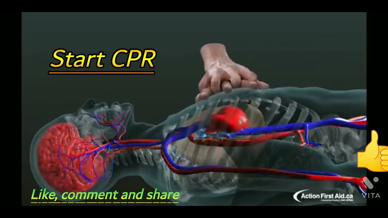 CPR,কিভাবে একজন প্রাপ্ত বয়স্ক ব্যক্তিদের CPR দিতে হয়।(How to make a ...