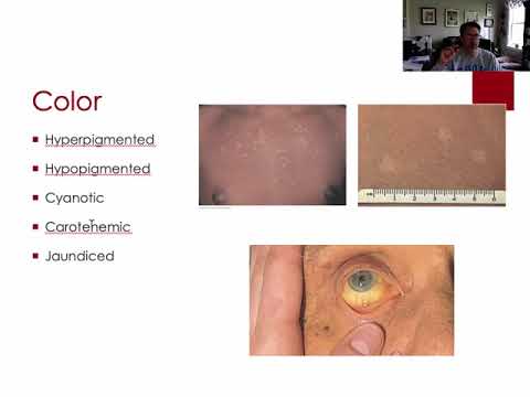 Skin and HEENT technique and abnormals - YouTube