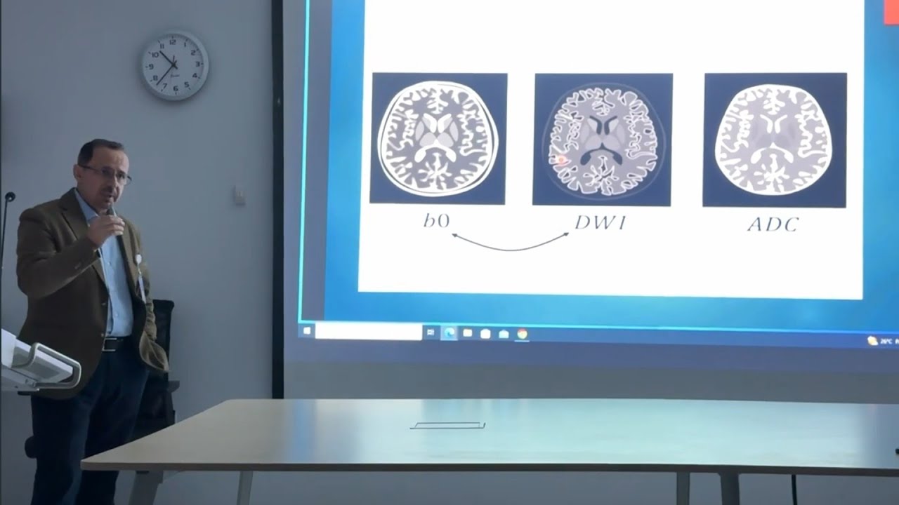 Diffusion weighted images and apparent diffusion coefficient (part 2 ...