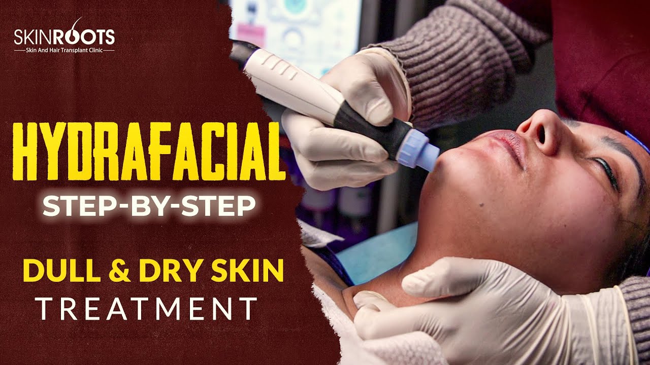 HydraFacial Procedure & Benefits | Treatment for Clear and Glowing Skin ...