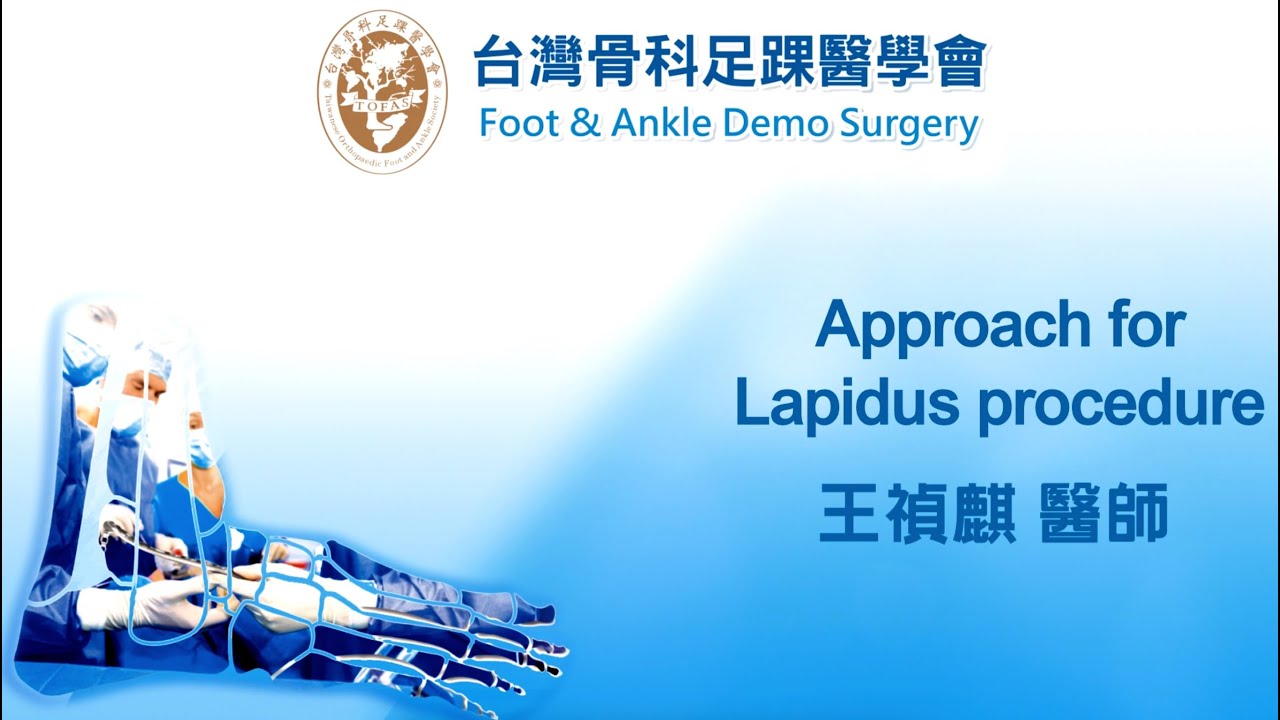 【Lapidus Procedure】 Education video. Introduce by 王禎麒醫師 - YouTube
