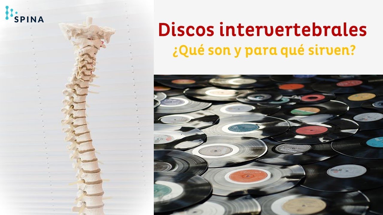 Discos intervertebrales ¿Qué son y para qué sirven? 👨‍⚕️👩‍⚕️ - YouTube