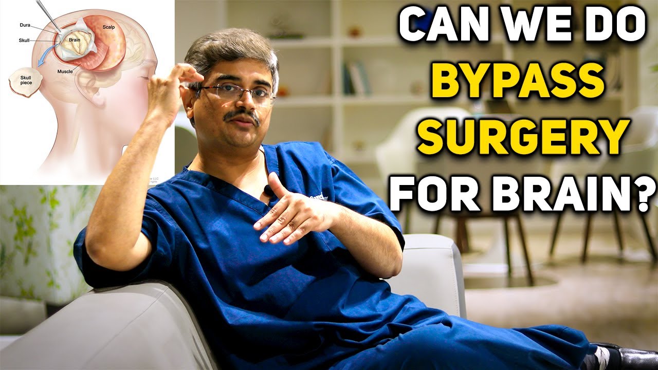 Can We Do Bypass Surgery For Brain? Dr.Roopesh Kumar - YouTube