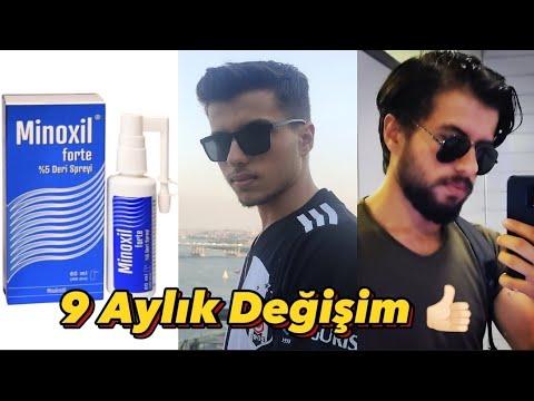 Minoxil Forte 5 Sakal Çıkarıyor Mu ? 9 Aylık Tecrübem