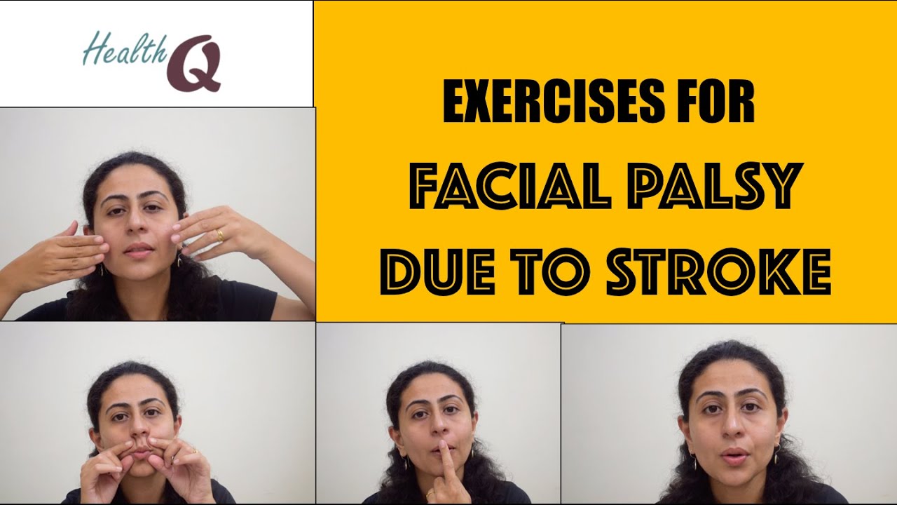 EXERCISES FOR STROKE RELATED FACIAL PALSY YouTube