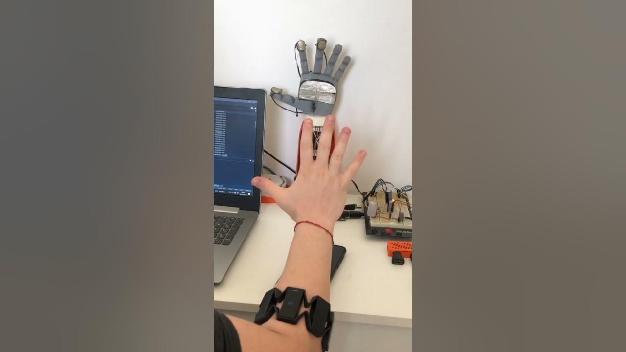 Real Time Movement Classification and Robotic Prosthesis Control - YouTube