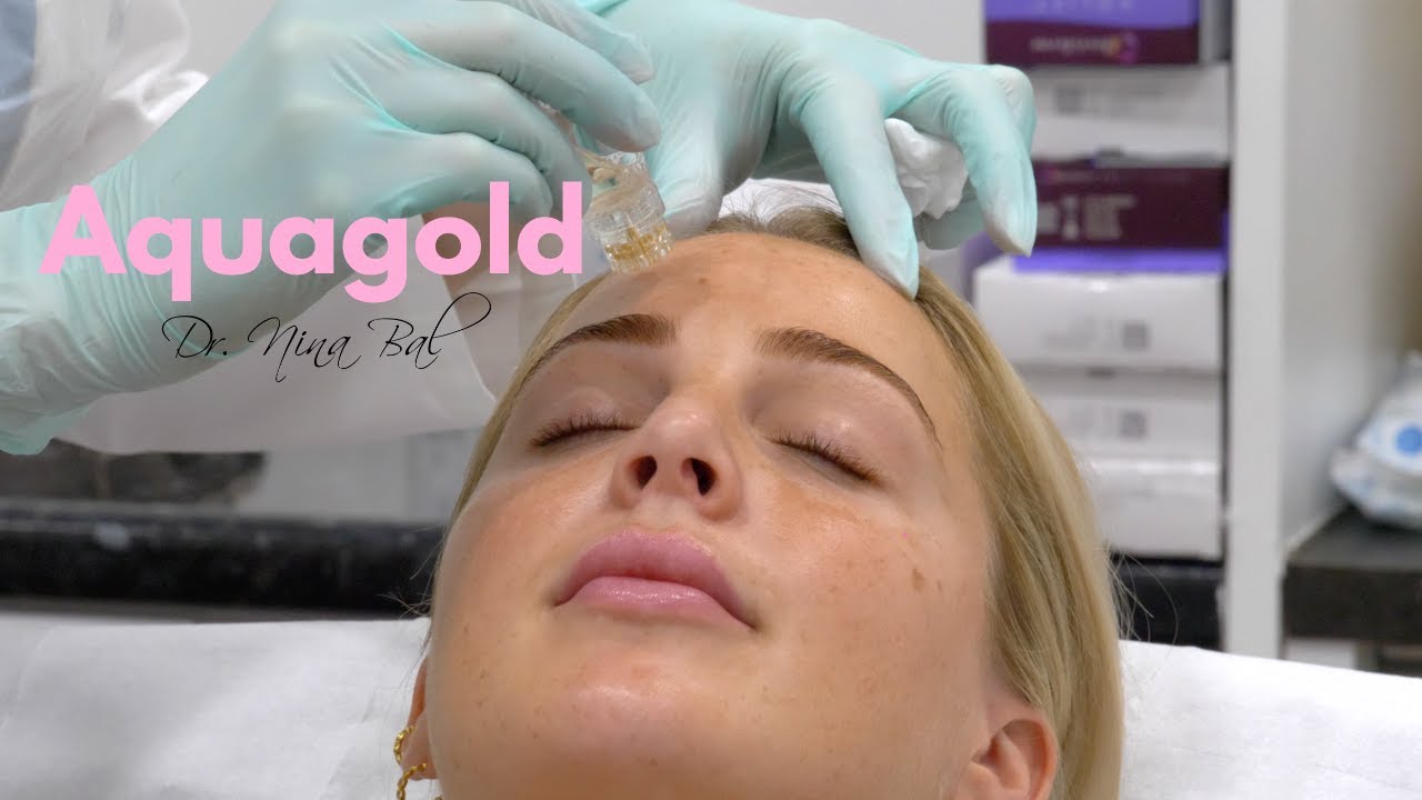 Aqua Gold Facial Before and After with Chloe Dr. Nina Bal Facial ...