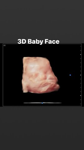 Look at this cute little 3D Baby Face 🥰 #jerbearimaging #3d #fyp #baby ...