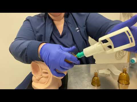 Penile traction (stretching after Xiaflex)