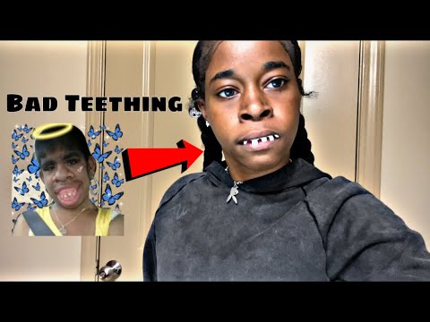 BAD TEETH *PRANK* ON MY BOYFRIEND 😂😂 - YouTube