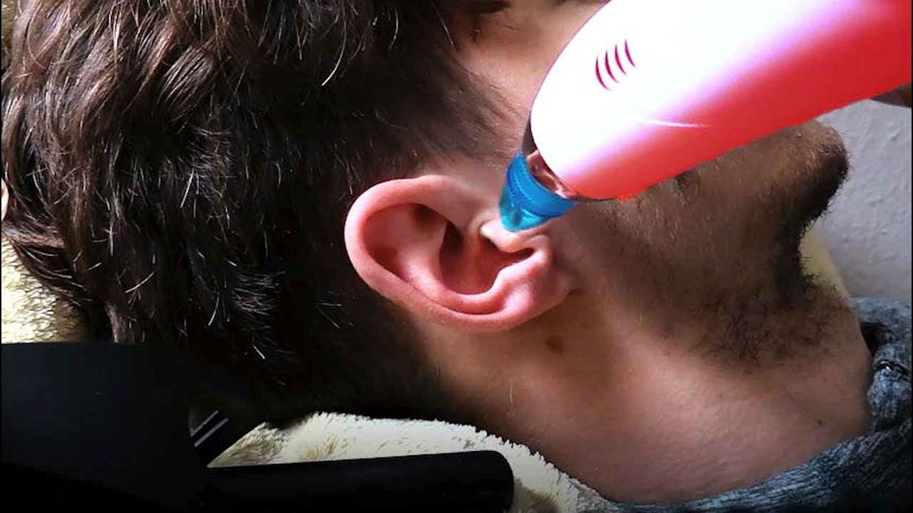 Asmr Tingly Ear Cleaning Extraction Massage Real Person Youtube