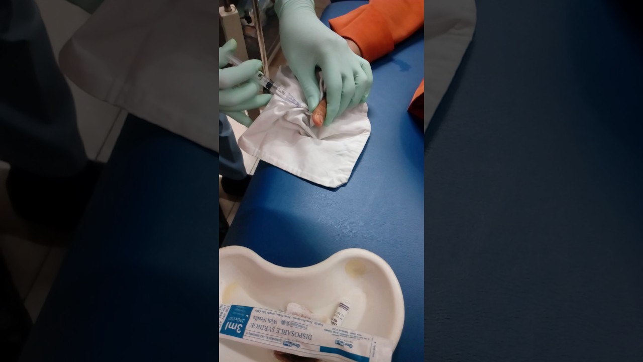 Teknik cross incision untuk luka tusuk - YouTube