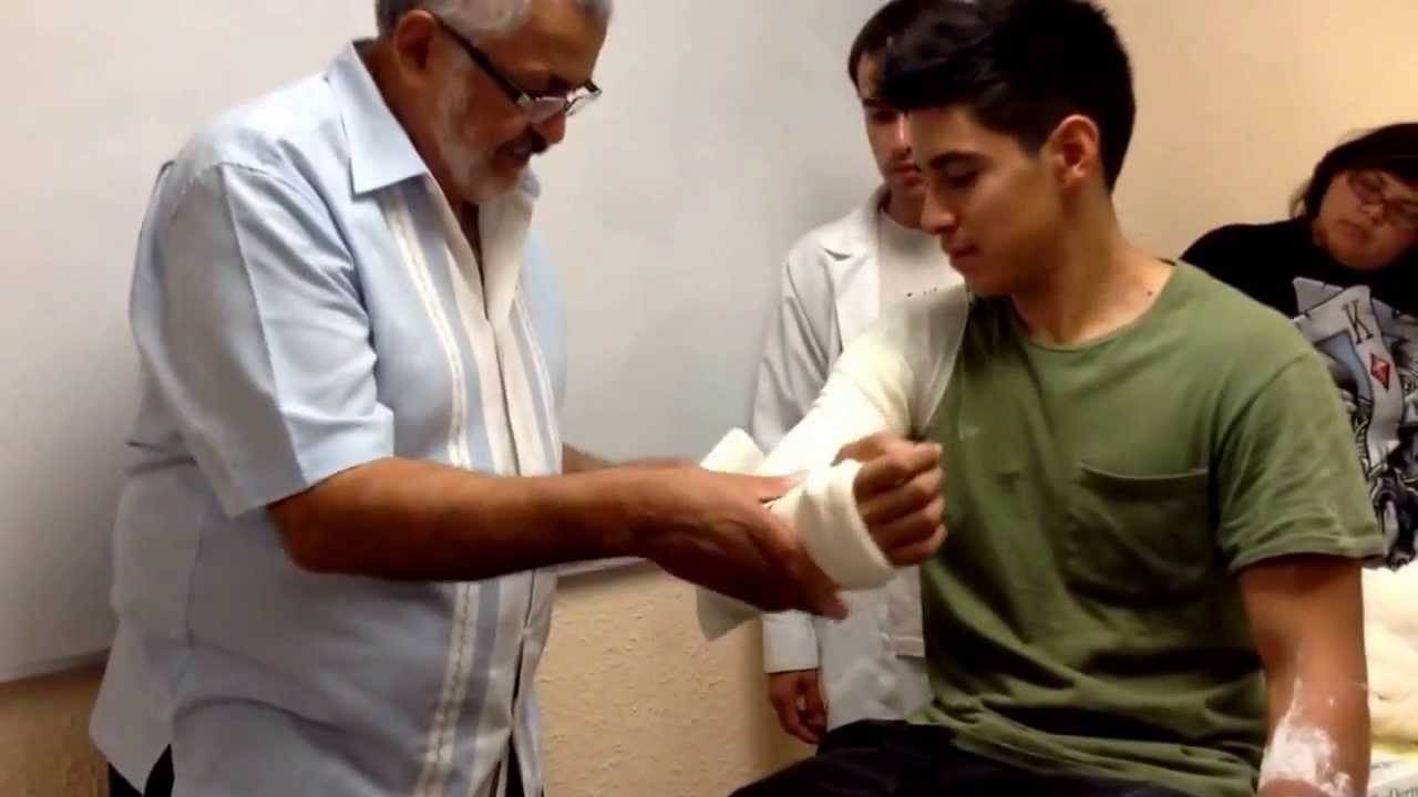 Ferula en pinza de azucar ferula en u - YouTube