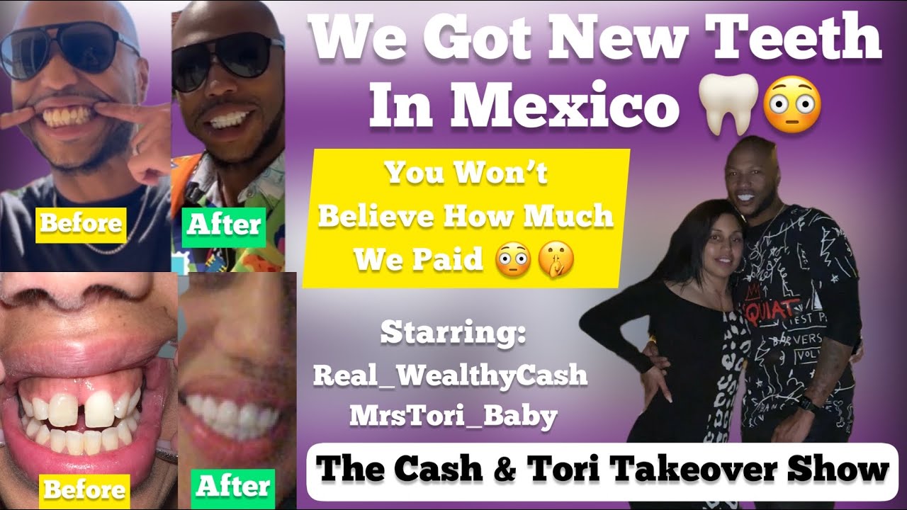 WE GOT NEW TEETH IN MEXICO 🇲🇽 - YouTube
