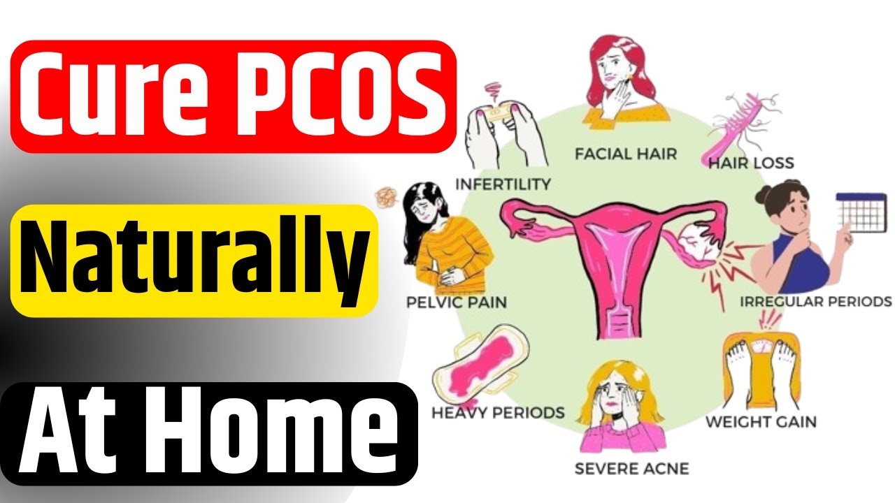 PCOS को जड़ से खत्म कैसे करें | How to cure PCOS Naturally - YouTube