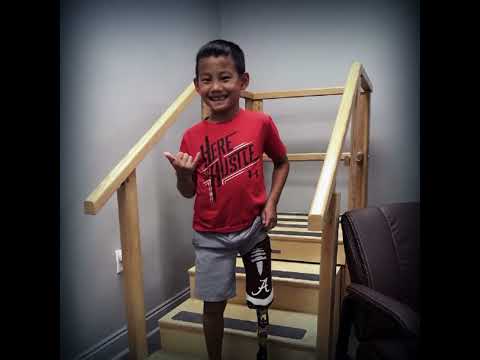 April is Limb Loss/ Limb Difference Awareness Month . - YouTube