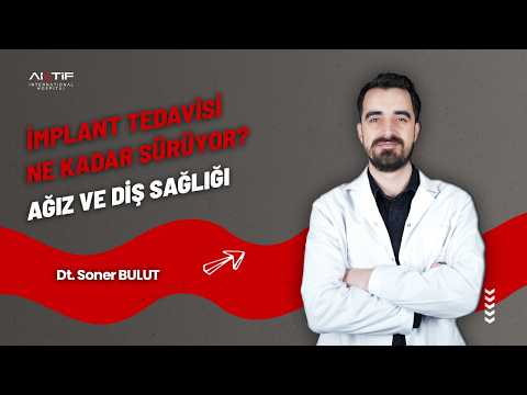 Dt. Soner Bulut: İmplant Ne Kadar Sürer? İmplant Tedavisi Sonrası İyileşme Aşamaları
