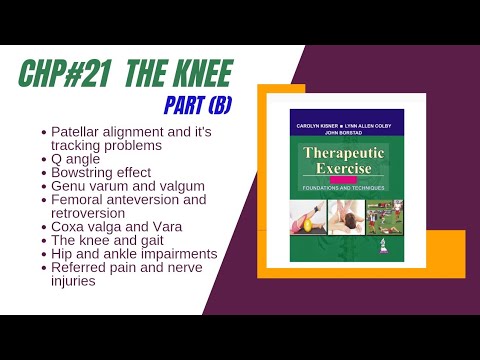Patellar Alignment&tracking problems|Increase or decrease Q angle ...